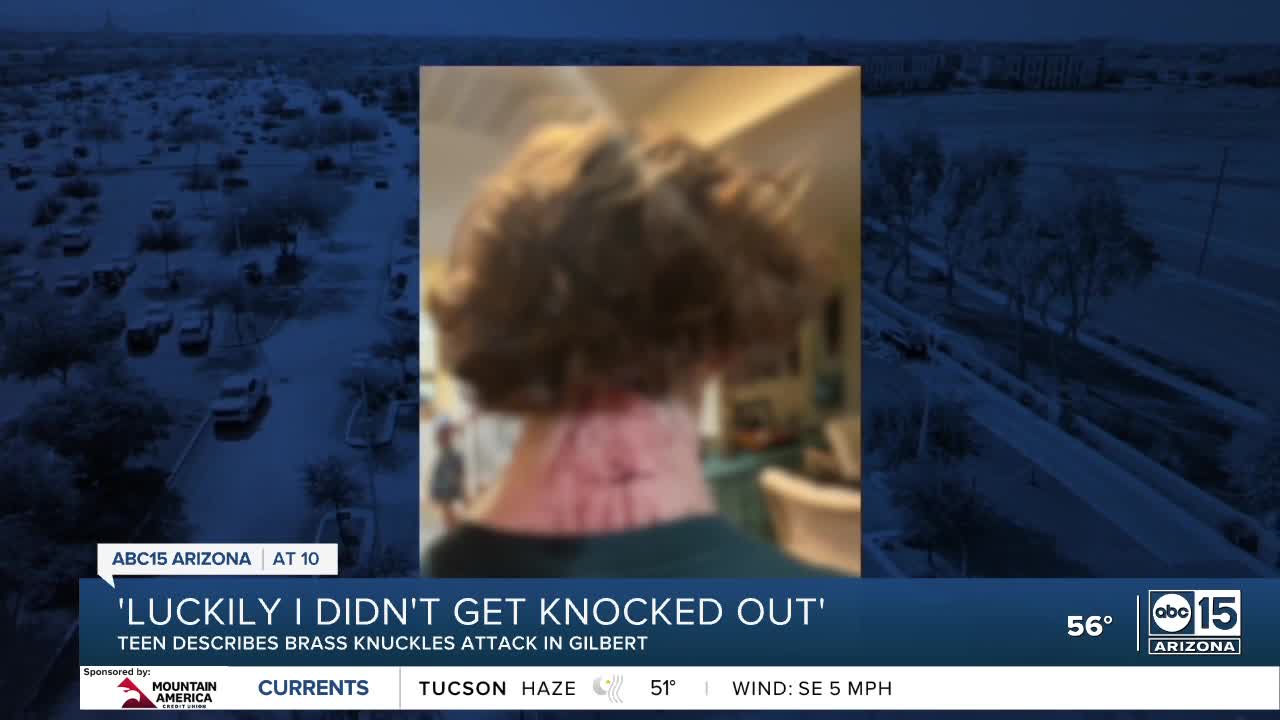 Teen pushing for brass knuckle legislation after violent attacks in ...