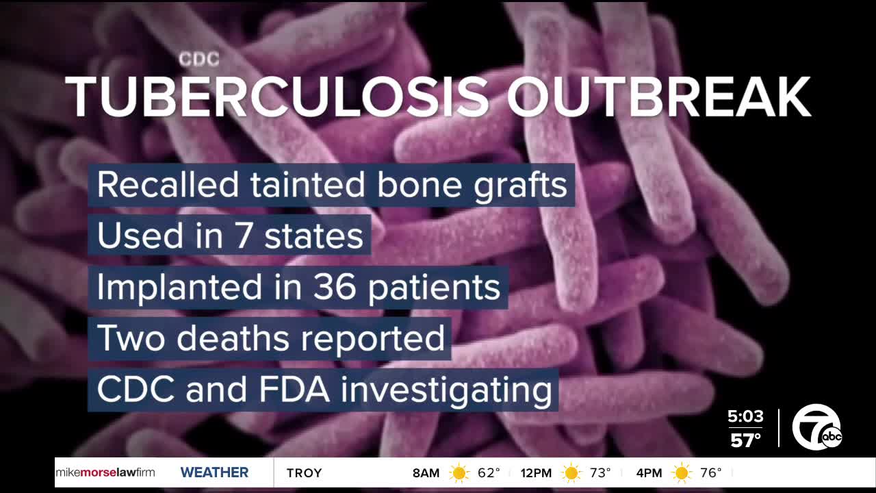 Tuberculosis death of Michigan woman linked to tainted bone graft after ...