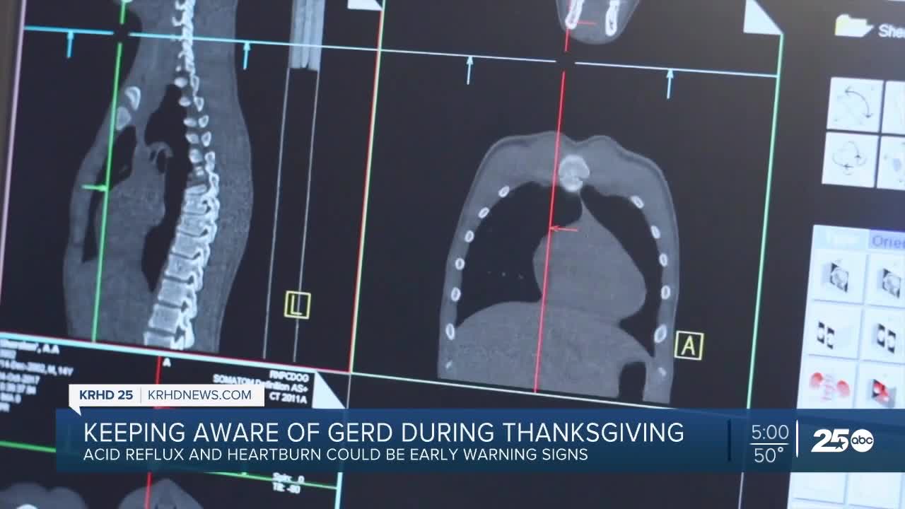 A new device is helping treat acid reflux and heartburn ahead of the ...