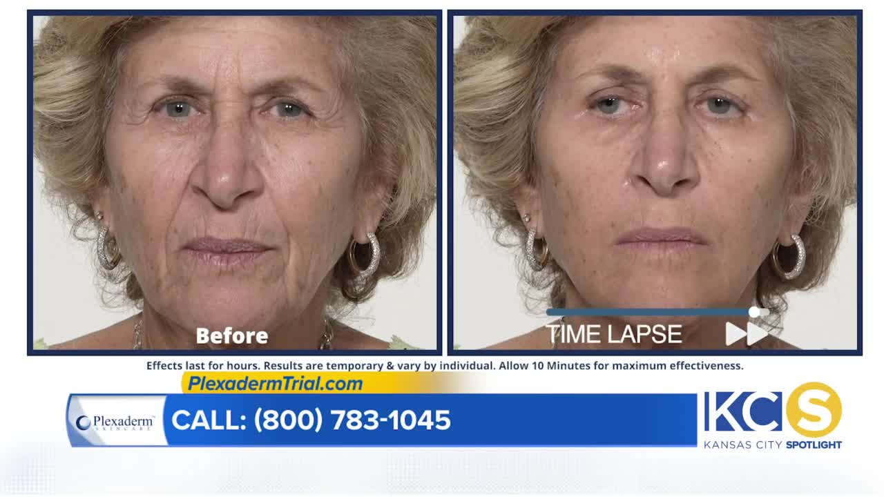 Look younger in 10 minutes with Plexaderm