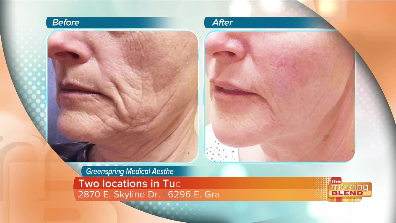 Look years younger with a non-surgical facelift