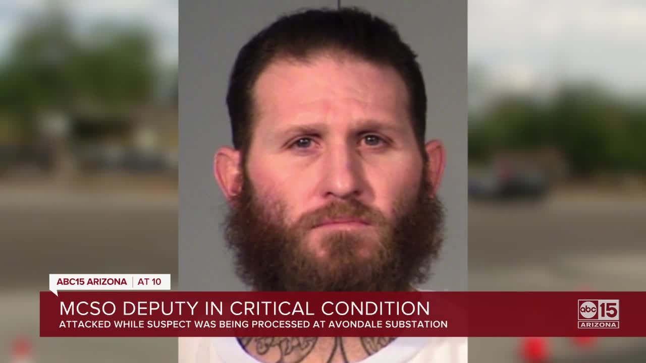 MCSO deputy dies following attack, family to donate his organs