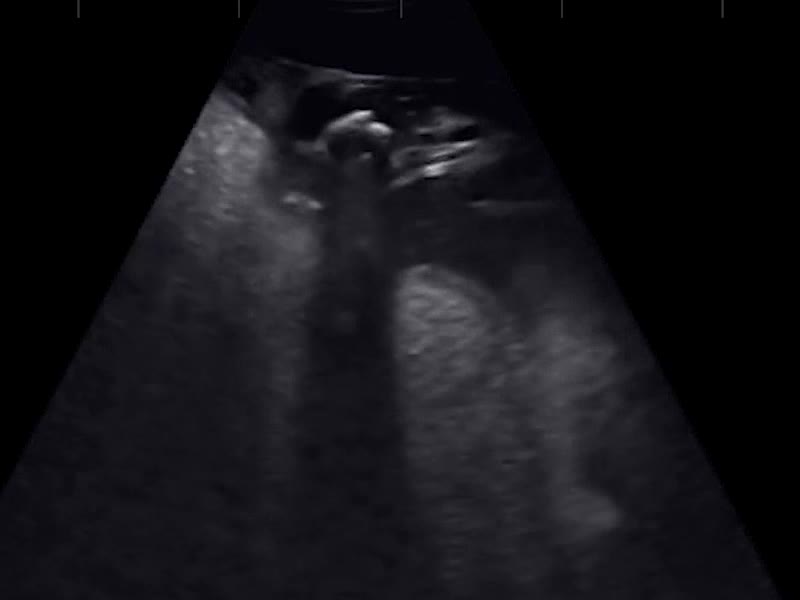 Cheyenne Mountain Zoo welcomes baby giraffe