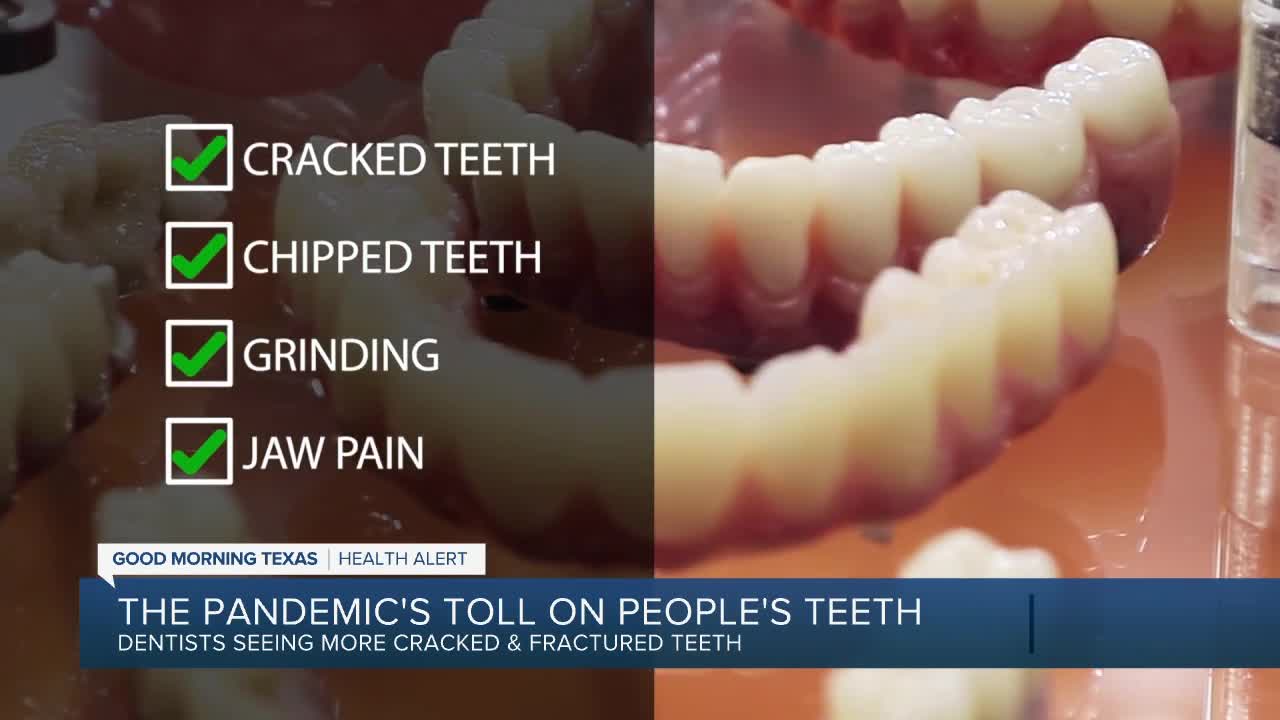 Dentists see spike in cracked teeth amid pandemic