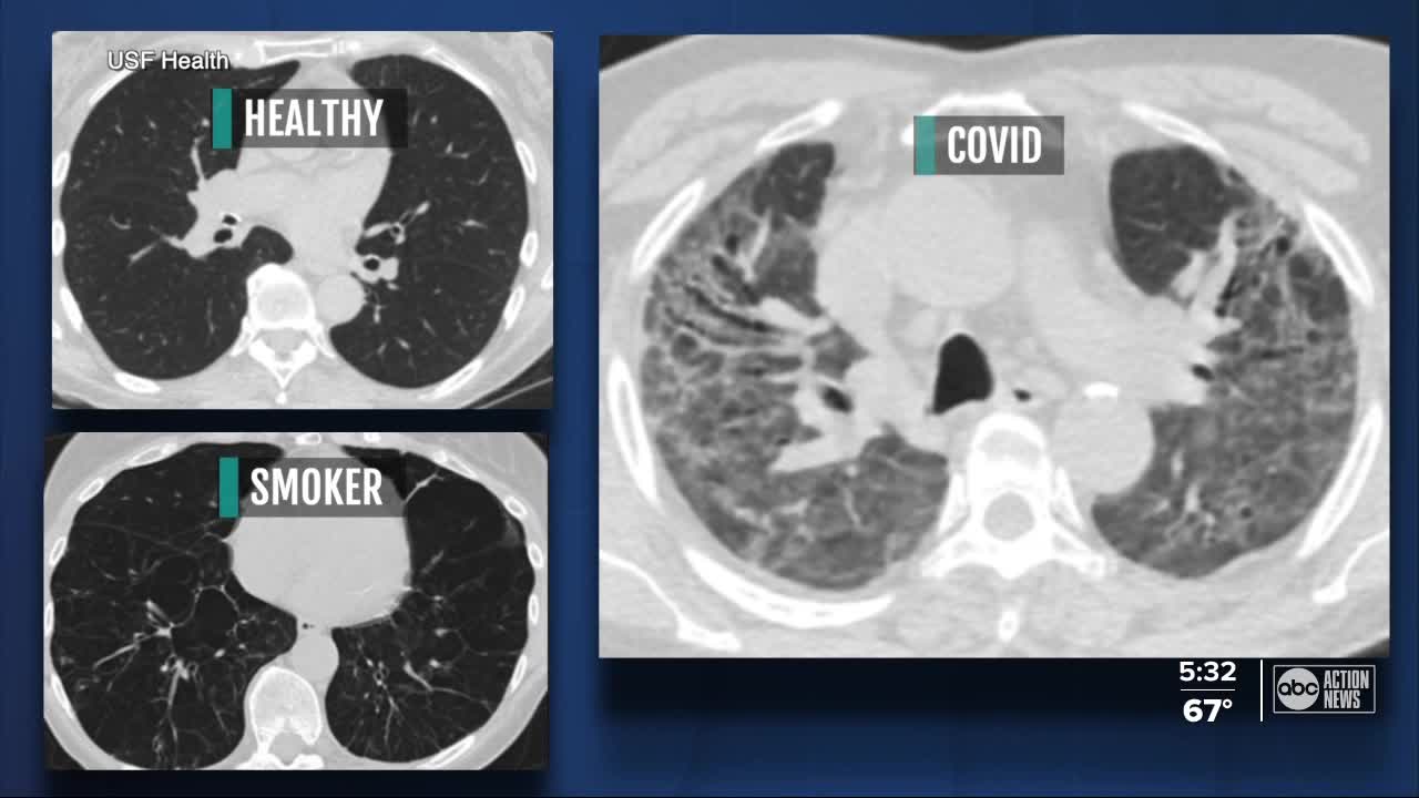 Damaged Lungs
