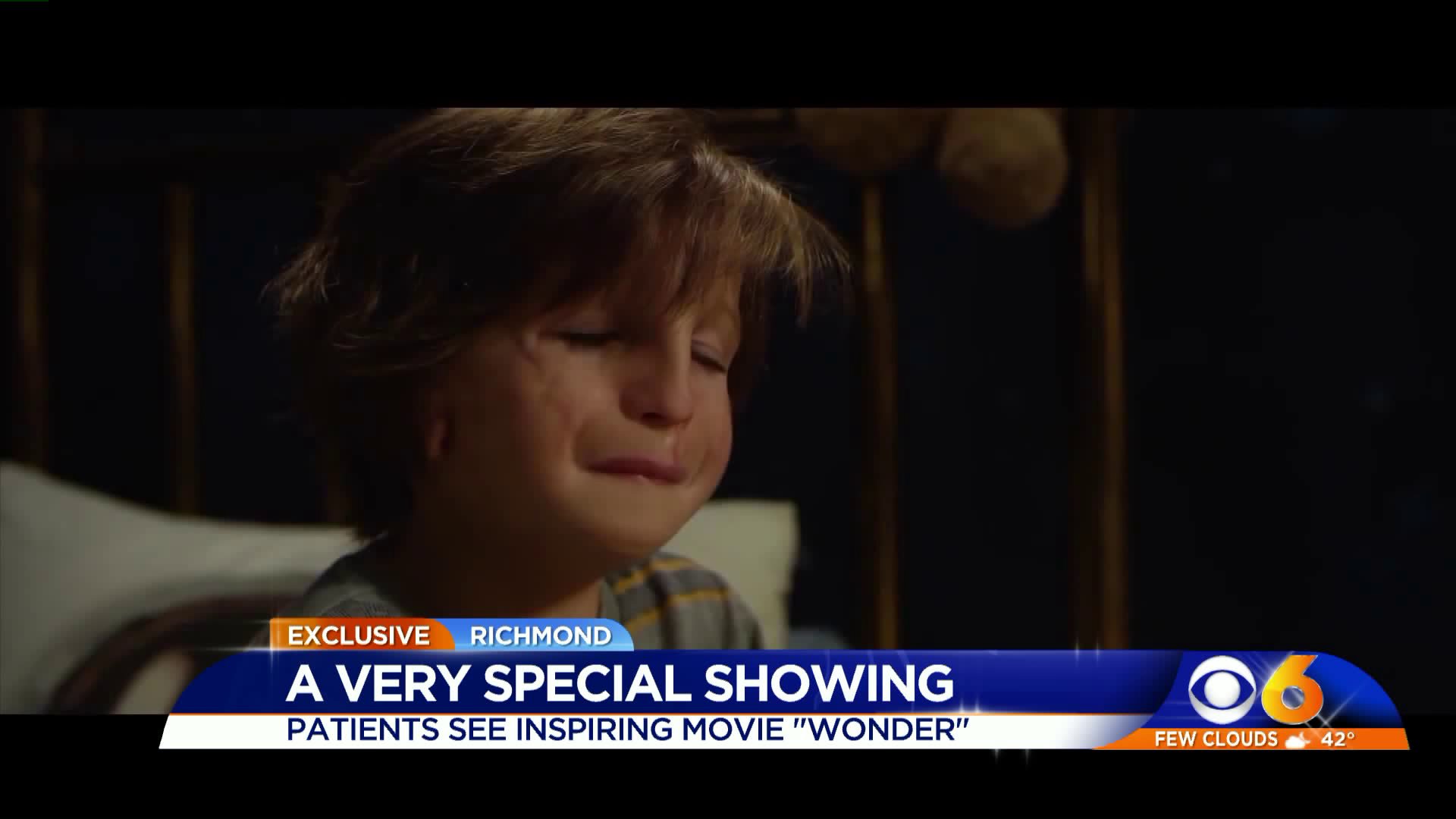 ‘Wonder’ viewing inspires local pediatric patients with facial differences