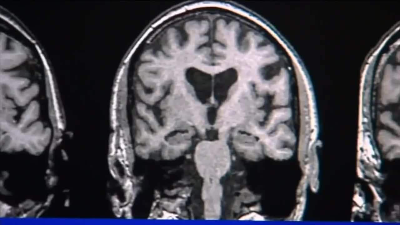 Understanding the relation between physical injuries and mental health