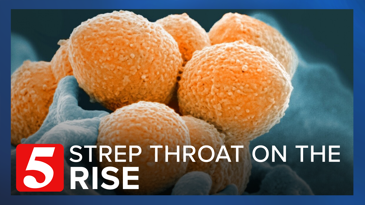 Strep throat is on the rise in the US
